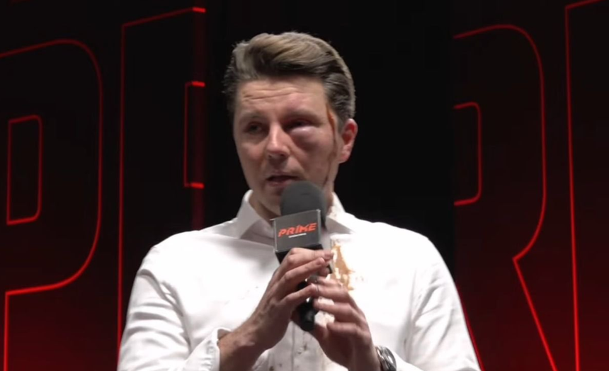 Korczarowski z podbitym okiem na konferencji. Pobił go Jaś Kapela - Melo